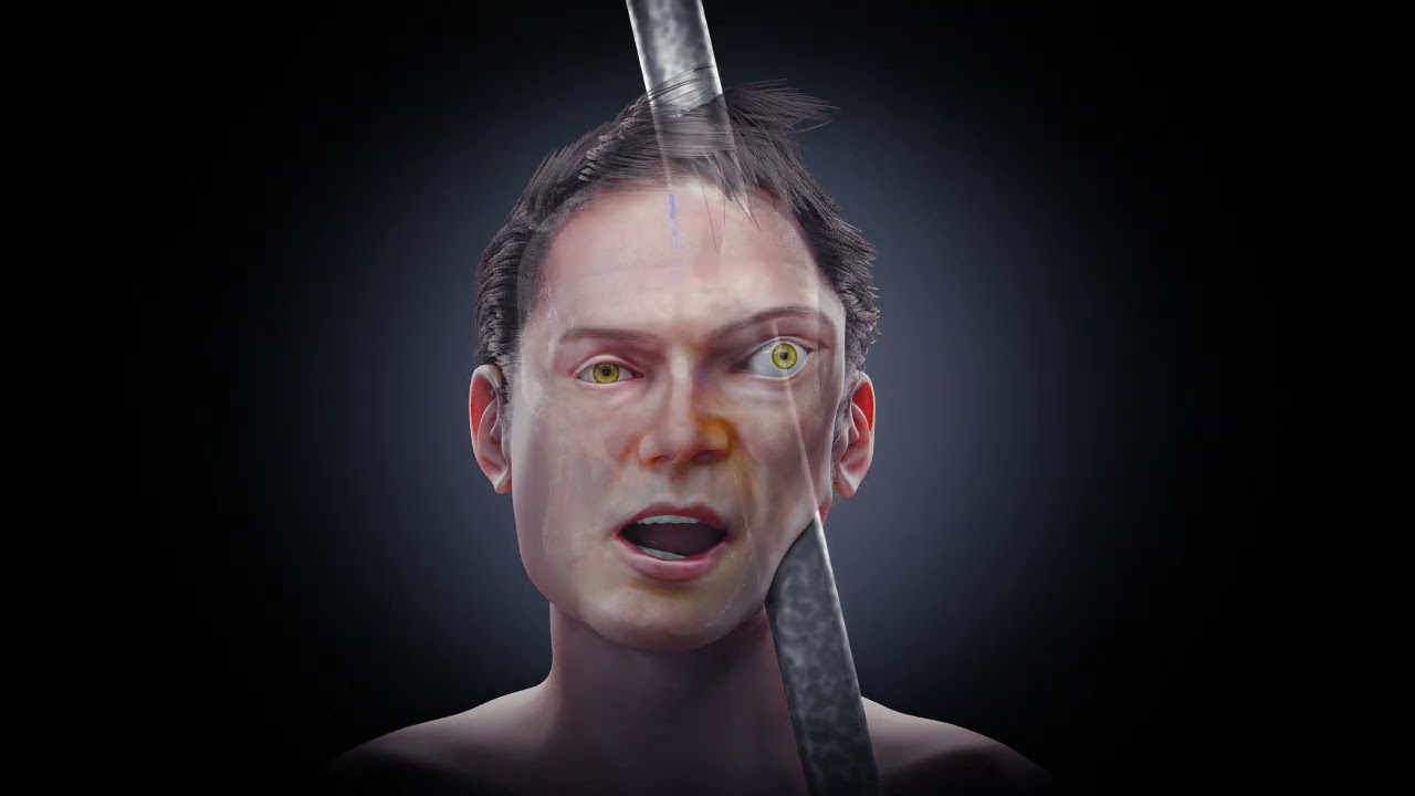 Scientists reconstruct the face of a man whose skull was pierced by an ...