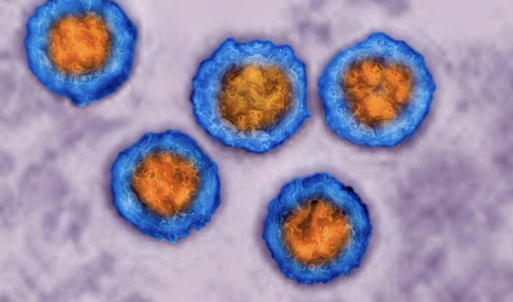 Scientists attempt to recreate 50,000-year-old ancient 'herpes' viruses ...