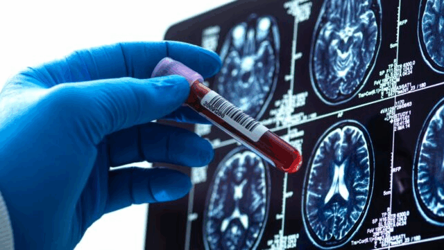 B(A): Scientists Discover World’s Rarest Blood Group Found in Only 3 People